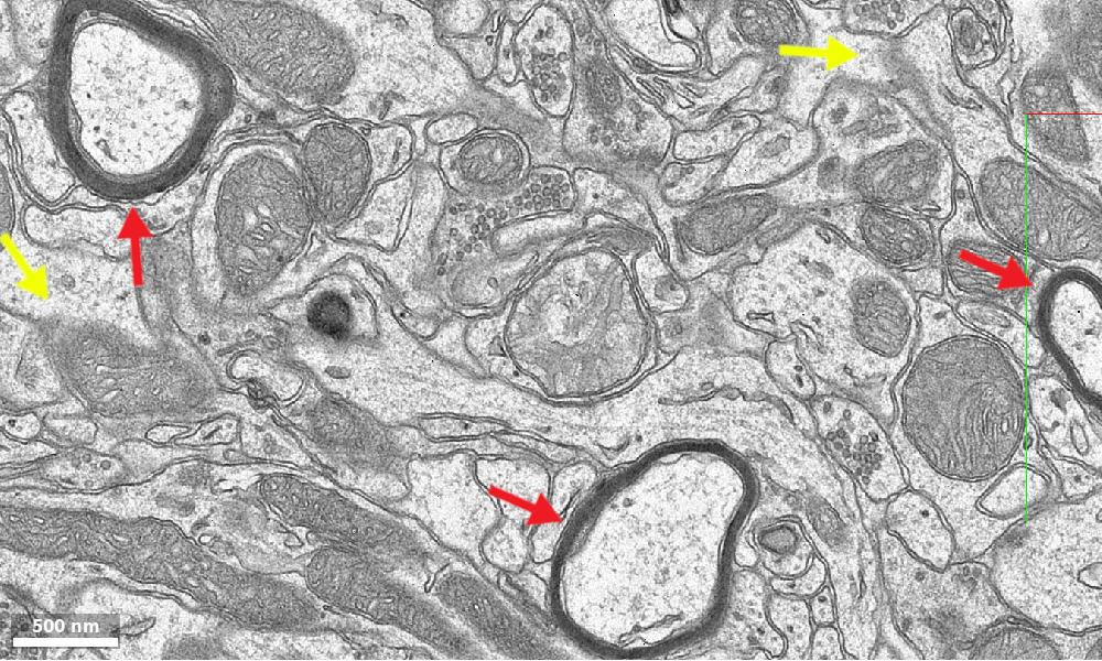 Open access 3D electron microscopy datasets of brains | A blog about ...