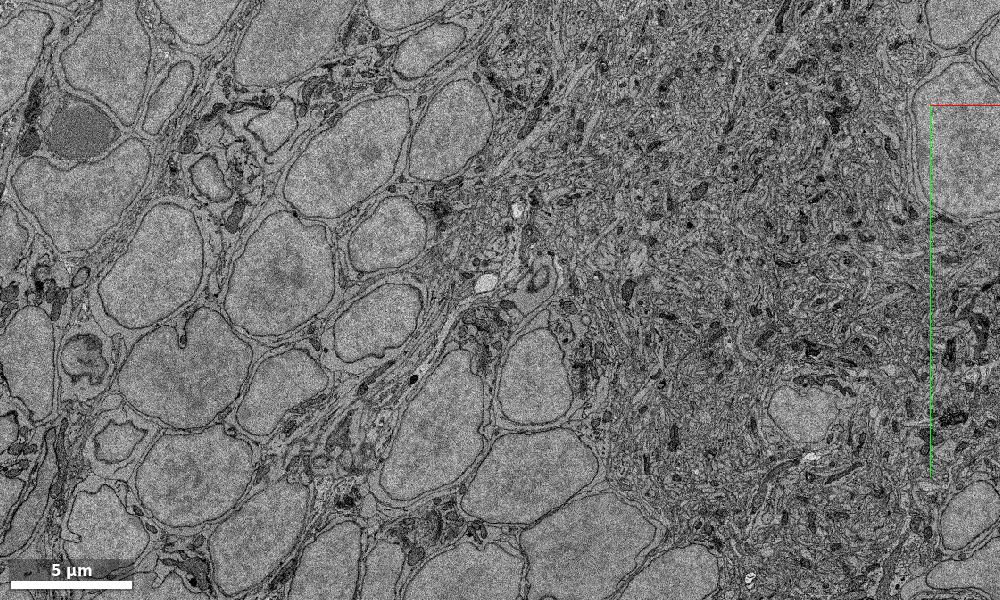 Open access 3D electron microscopy datasets of brains | A blog about ...